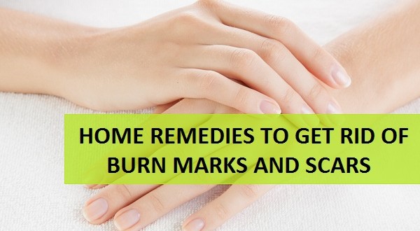 How to get rid of the Burn Marks and Scars at home