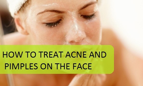 How to treat Acne and Pimples on the face