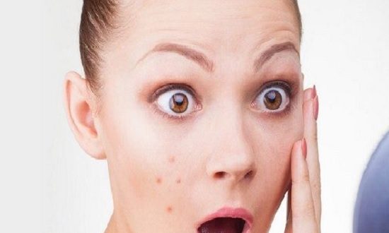 Natural Remedies for Scars and Marks on Face and Body